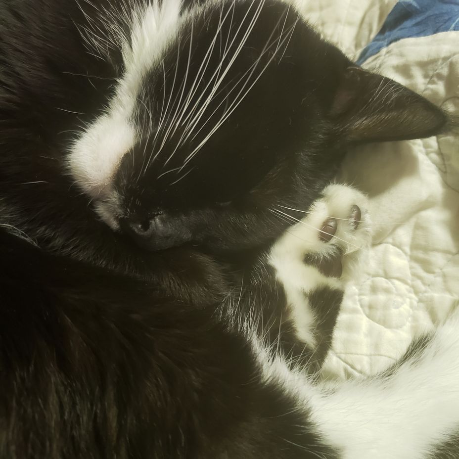 toebeans | Signs, Symptoms, Support